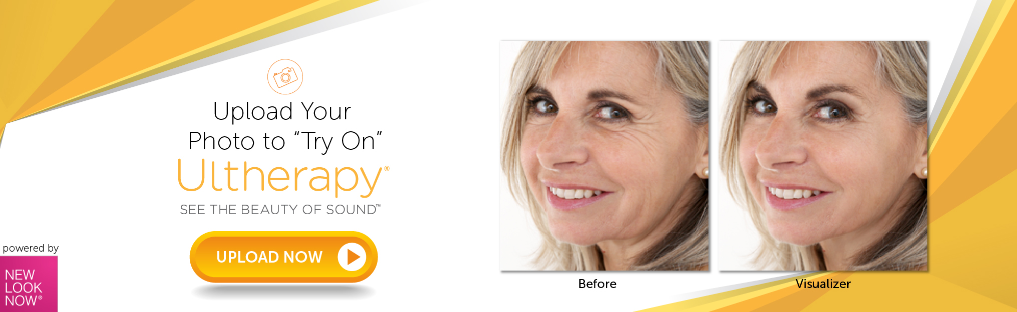 Ultherapy Skin Tightening New Jersey Montclair NJ